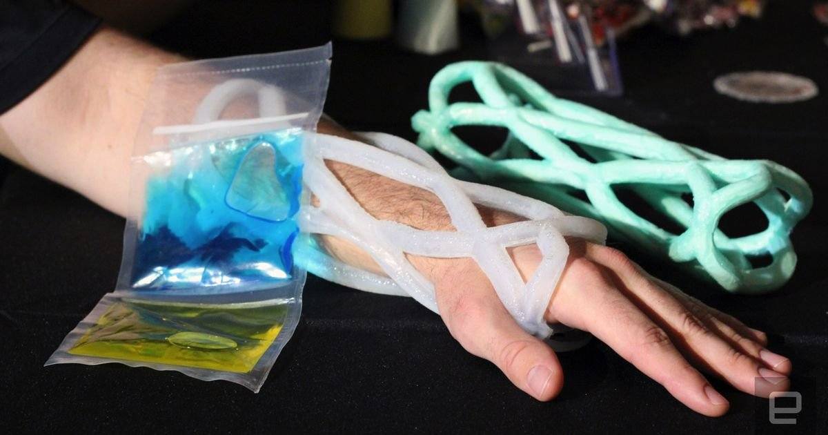 Science creates a cast that lets you scratch those itches | AMERICAN ...